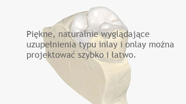 Exocad DentalCAD Elefsina :: Exocad